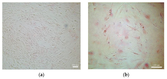 Irisin: A Possible Marker of Adipose Tissue Dysfunction in Obesity