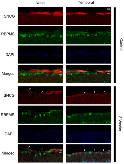 Differential Responses of Retinal Neurons and Glia Revealed via ...