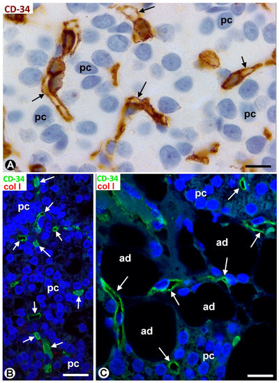 Telocytes/CD34+ Stromal Cells in the Normal, Hyperplastic, and ...