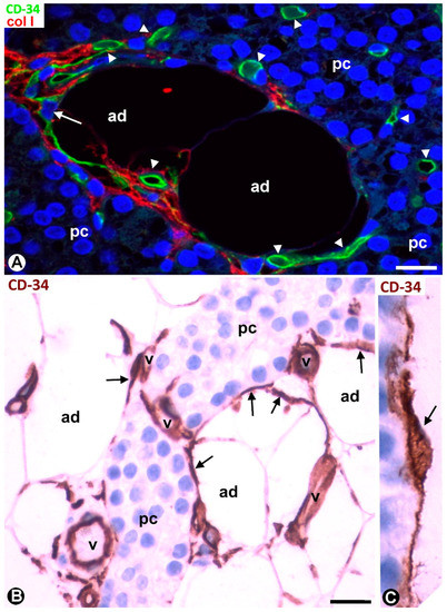 Telocytes/CD34+ Stromal Cells in the Normal, Hyperplastic, and ...