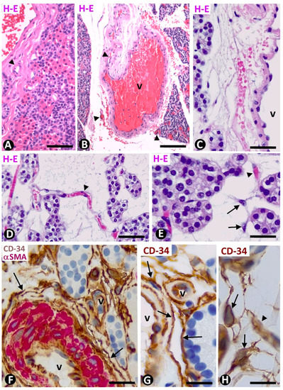 Telocytes/CD34+ Stromal Cells in the Normal, Hyperplastic, and ...