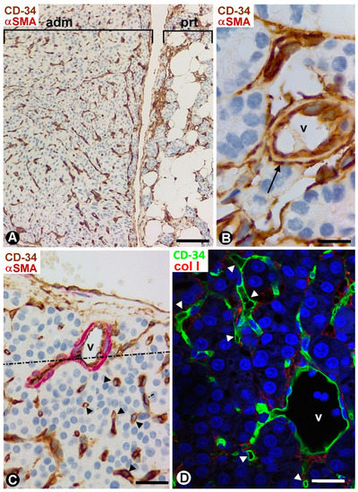 Telocytes/CD34+ Stromal Cells in the Normal, Hyperplastic, and ...