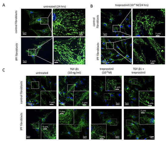 IJMS | Free Full-Text | Treprostinil Reconstitutes Mitochondrial ...