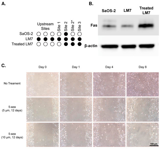 The Role of FAS Receptor Methylation in Osteosarcoma Metastasis