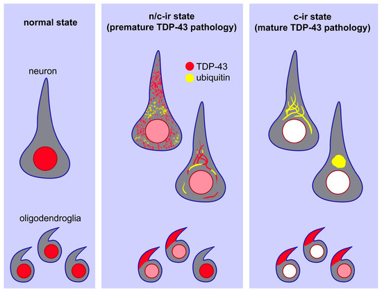 Nuclear Expression of TDP-43 Is Linked with Morphology and ...