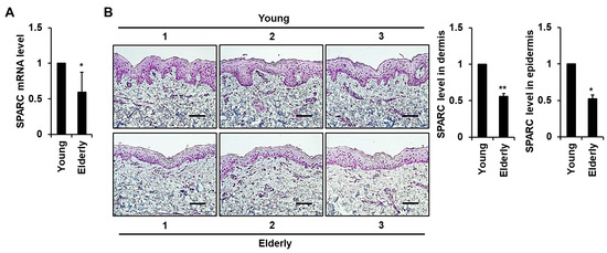 SPARC Is Highly Expressed in Young Skin and Promotes Extracellular ...