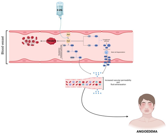 Neurologic and Psychiatric Manifestations of Bradykinin-Mediated ...