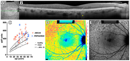 Primary versus Secondary Elevations in Fundus Autofluorescence