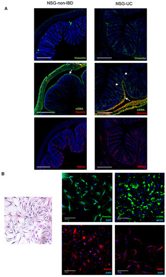 Humanized NSG Mouse Models as a Preclinical Tool for Translational ...