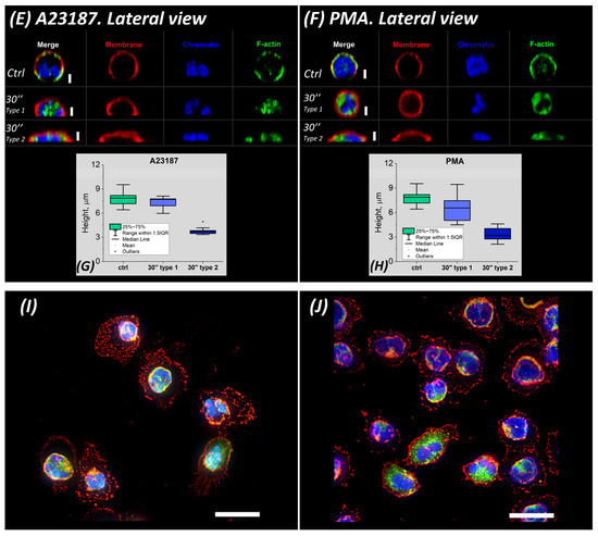 Stages of NETosis Development upon Stimulation of Neutrophils with ...