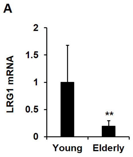 LRG1 Promotes ECM Integrity by Activating the TGF-β Signaling Pathway ...