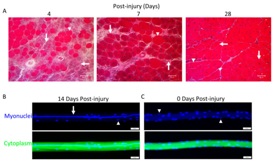 Regenerating Myofibers after an Acute Muscle Injury: What Do We Really ...