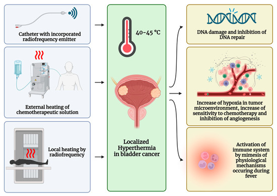 BCG-Unresponsive Non-Muscle-Invasive Bladder Cancer: Current Treatment ...