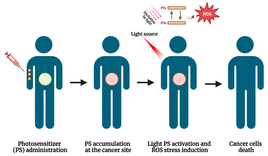 BCG-Unresponsive Non-Muscle-Invasive Bladder Cancer: Current Treatment ...