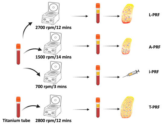 Current Progress of Platelet-Rich Derivatives in Cartilage and Joint ...