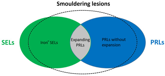 Smouldering Lesion in MS: Microglia, Lymphocytes and Pathobiochemical ...