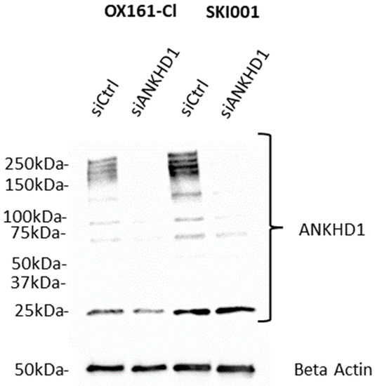 Evaluating the Molecular Properties and Function of ANKHD1, and Its ...