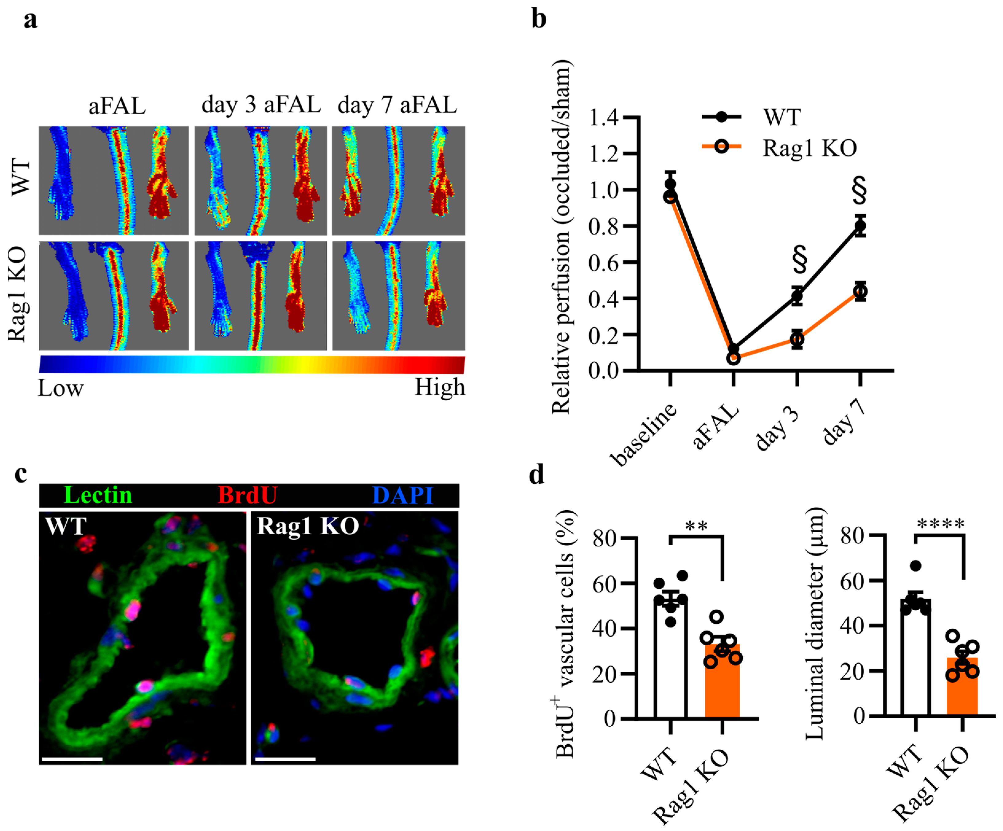 IJMS | Free Full-Text | Rag1 Deficiency Impairs Arteriogenesis in Mice IJMS | Free Full-Text | Rag1 Deficiency Impairs Arteriogenesis in Mice
