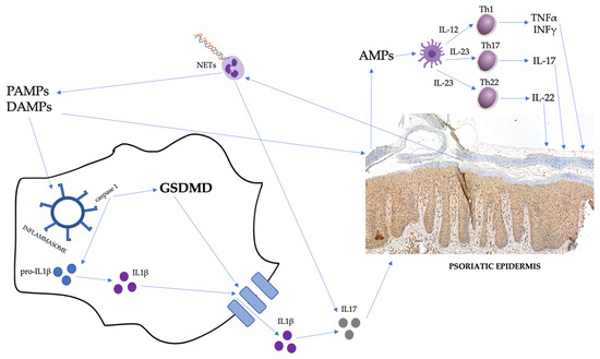 Gasdermin D (GSDMD) Is Upregulated in Psoriatic Skin—A New Potential ...