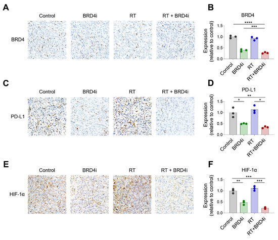 BRD4 Inhibition Enhances the Antitumor Effects of Radiation Therapy in ...
