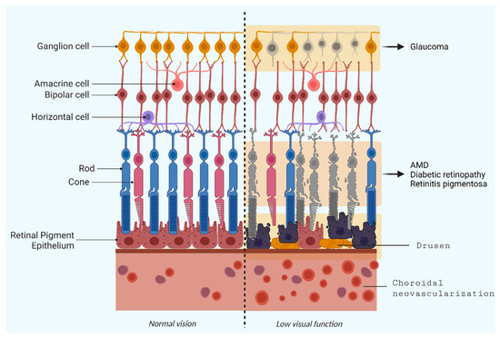 Revisiting Retinal Degeneration Hallmarks: Insights from Molecular ...