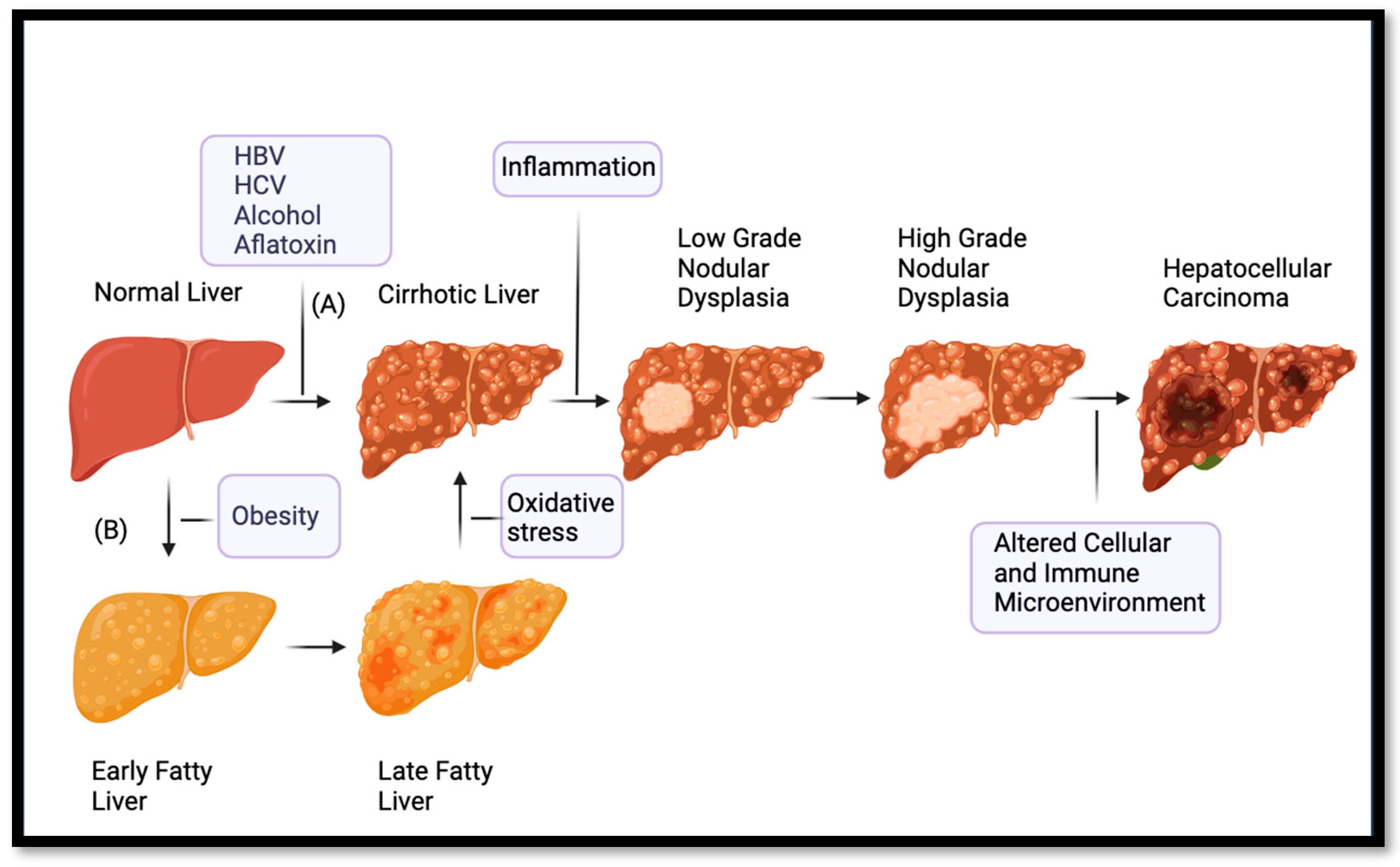 Ijms Free Full Text Hepatocellular Carcinoma Past And Present