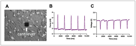 IJMS | Free Full-Text | Single-Cell Analysis of Contractile Forces in ...
