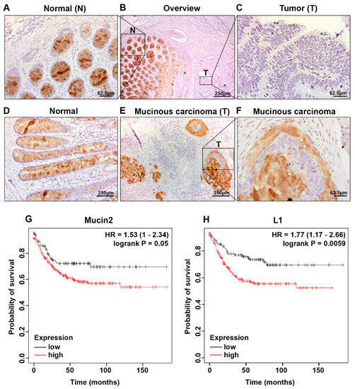 An Increase in Mucin2 Expression Is Required for Colon Cancer ...