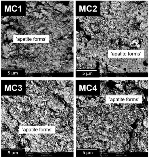 Novel Double Hybrid-Type Bone Cements Based on Calcium Phosphates ...