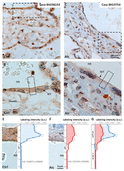 Prenatal Alcohol Exposure Impairs the Placenta–Cortex Transcriptomic ...