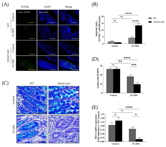 IJMS | Free Full-Text | VDUP1 Deficiency Promotes the Severity of DSS ...