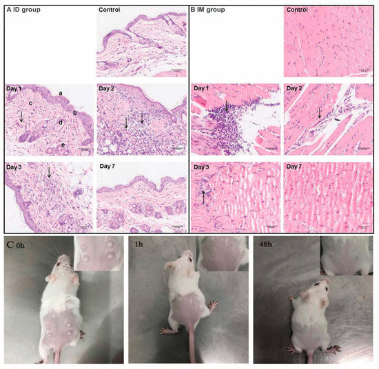 Immune Response of Inactivated Rabies Vaccine Inoculated via ...