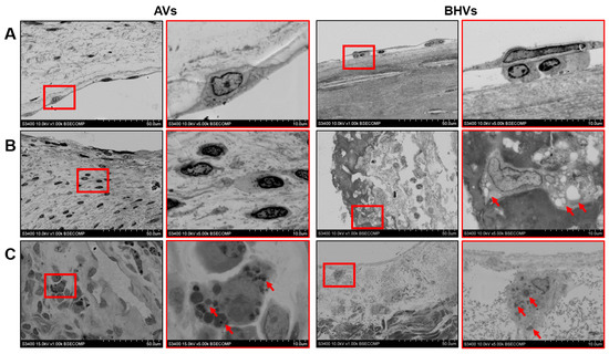 Embedding and Backscattered Scanning Electron Microscopy (EM-BSEM) Is ...