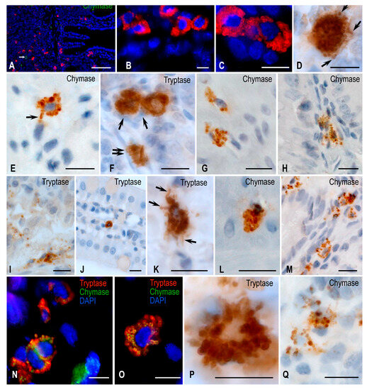 Space-Flight- and Microgravity-Dependent Alteration of Mast Cell ...