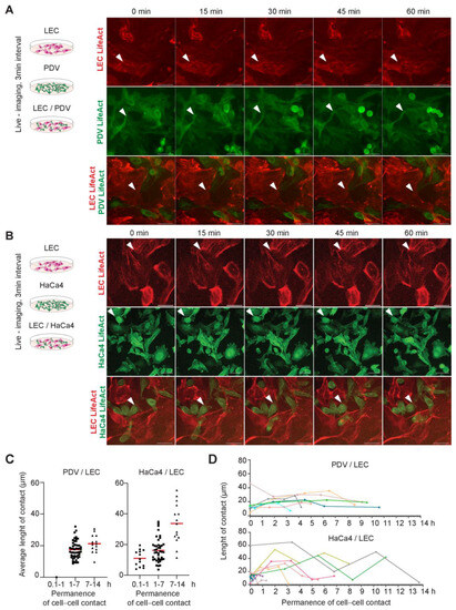 Lymph Vessels Associate with Cancer Stem Cells from Initiation to Malignant Stages of Squamous ...