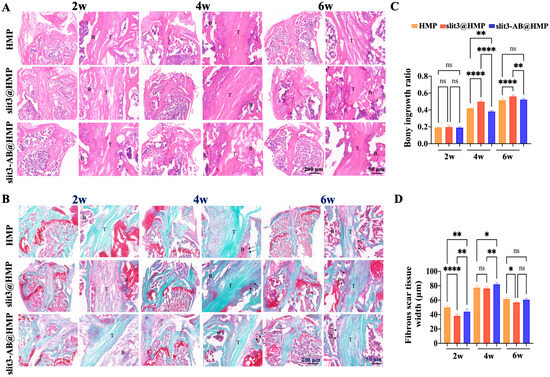 Slit Guidance Ligand 3 (SLIT3) Loaded in Hydrogel Microparticles ...