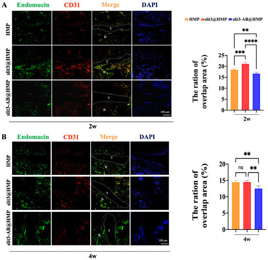Slit Guidance Ligand 3 (SLIT3) Loaded in Hydrogel Microparticles ...