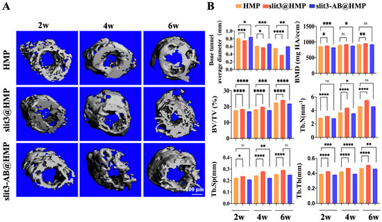 Slit Guidance Ligand 3 (SLIT3) Loaded in Hydrogel Microparticles ...