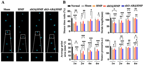 Slit Guidance Ligand 3 (SLIT3) Loaded in Hydrogel Microparticles ...