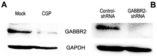 GABBR2 as a Downstream Effector of the Androgen Receptor Induces ...