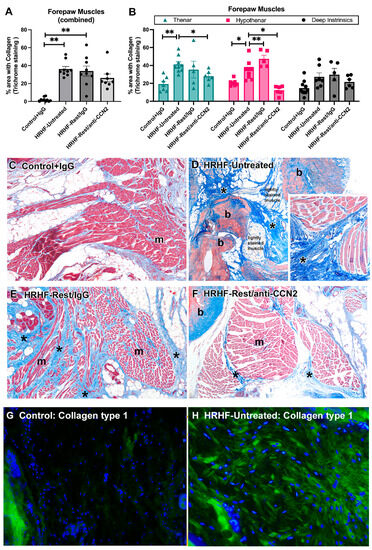 IJMS | Free Full-Text | Blocking CCN2 Reduces Established Palmar ...