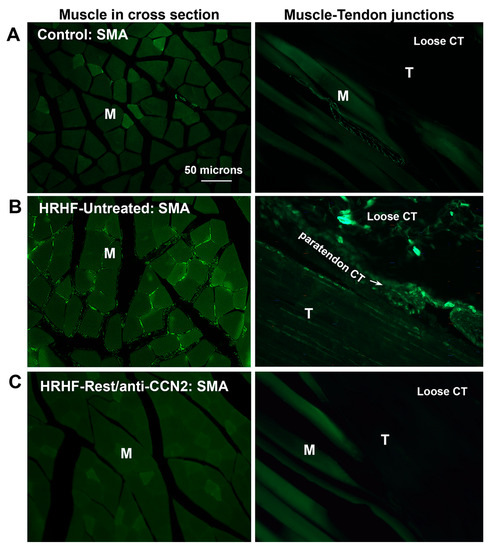 IJMS | Free Full-Text | Blocking CCN2 Reduces Established Palmar ...