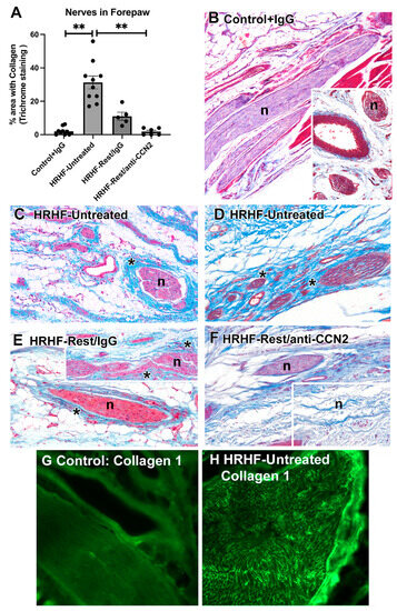 IJMS | Free Full-Text | Blocking CCN2 Reduces Established Palmar ...