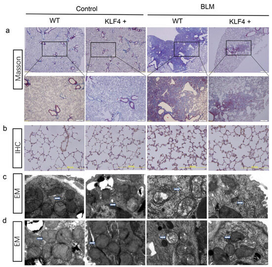 Overexpression of KLF4 Suppresses Pulmonary Fibrosis through the HIF-1α ...