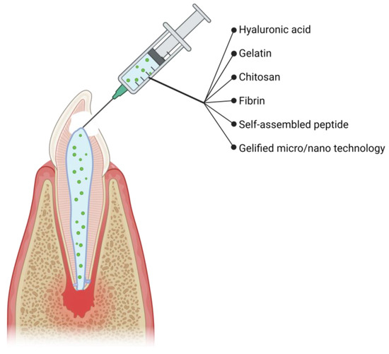 Bioactive Endodontic Hydrogels: From Parameters to Personalized Medicine