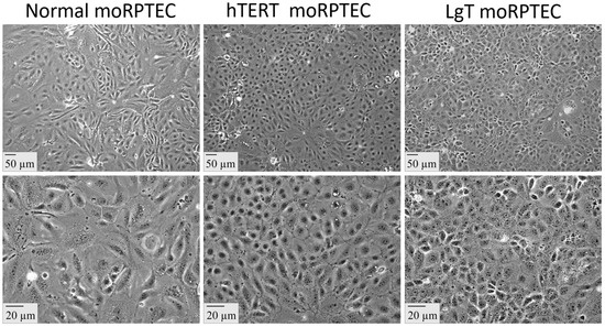 Insights into Repeated Renal Injury Using RNA-Seq with Two New RPTEC ...