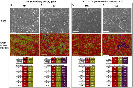 BMSC–HNC Interaction: Exploring Effects on Bone Integrity and Head and ...