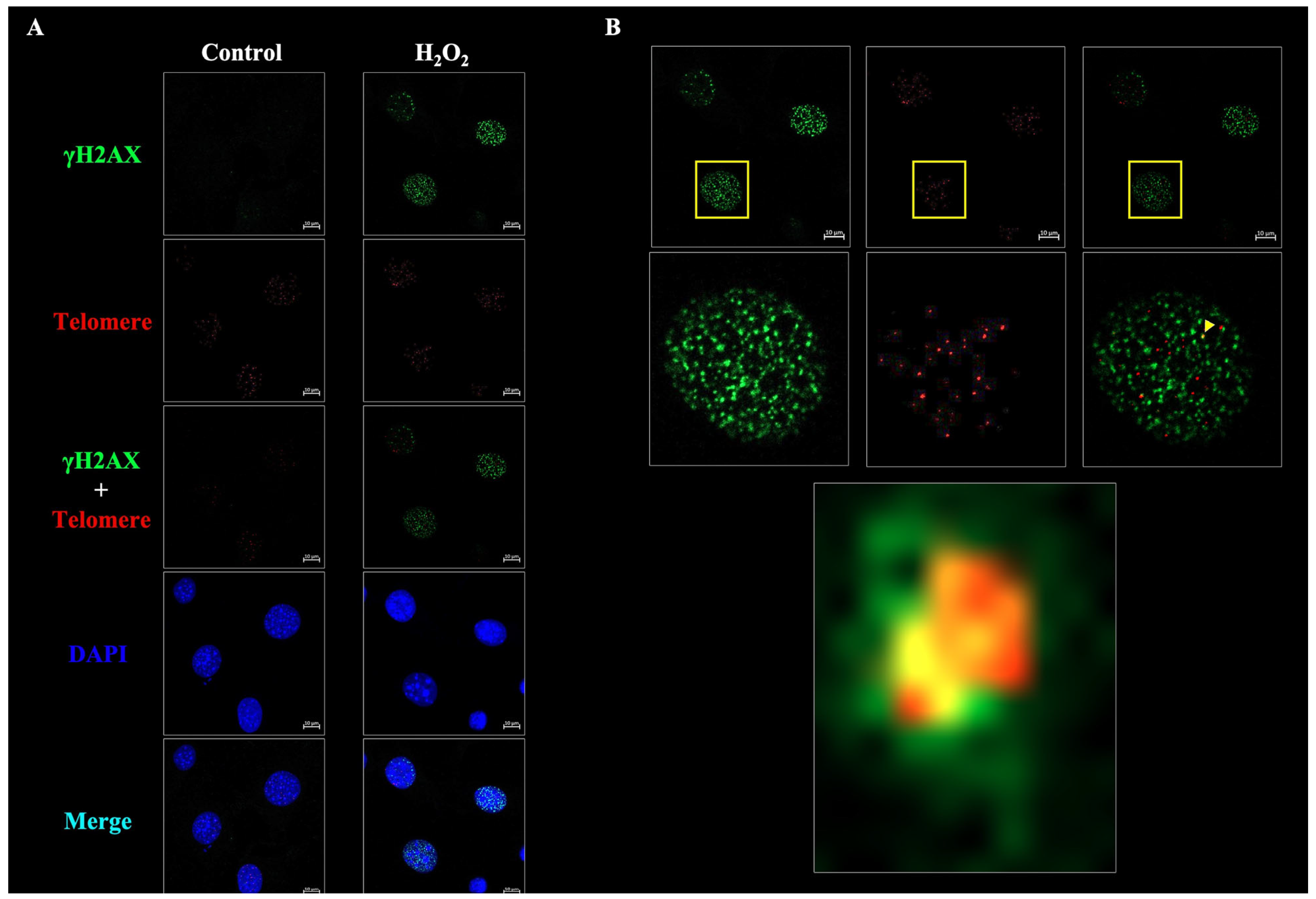 Foci-Xpress: Automated and Fast Nuclear Foci Counting Tool