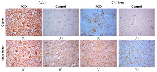 Expression of Cytoskeletal Proteins (GFAP, Vimentin), Proapoptotic ...