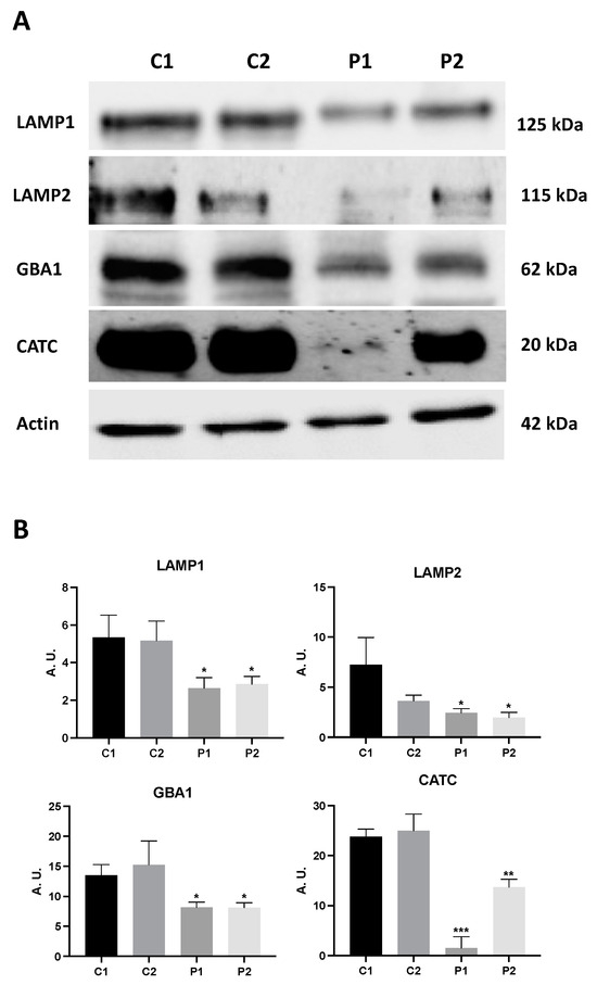 IJMS | Free Full-Text | Antioxidants Prevent Iron Accumulation and ...